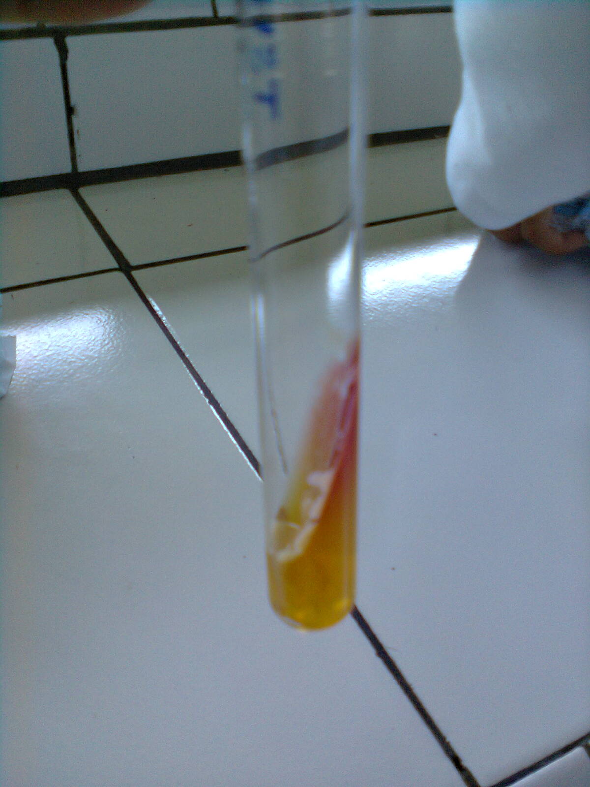 Teenoz Health Analyst: Gambar Hasil Identifikasi Klebsiella