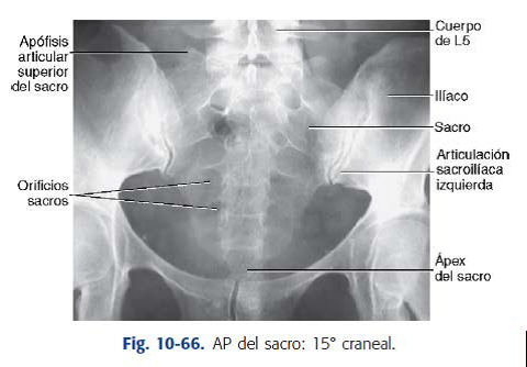 PRODUCCION Y TRATAMIENTO DE IMAGENES DIAGNOSTICAS: CAPITULO COLUMNA ...
