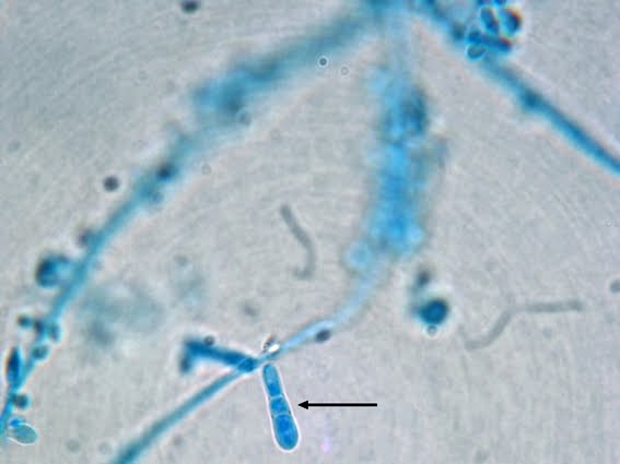 Fun With Microbiology (What's Buggin' You?): Trichophyton rubrum