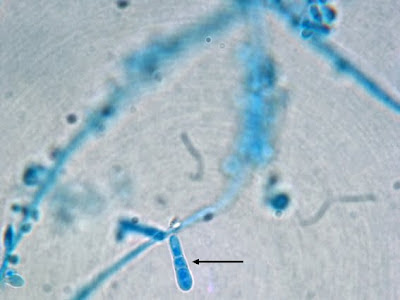 Fun With Microbiology (What's Buggin' You?): Trichophyton rubrum