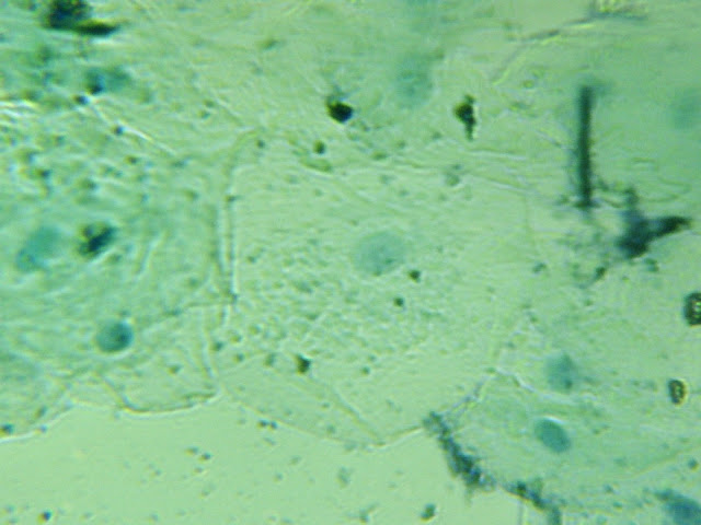 CIENCIAS JPL: CÉLULAS EPITELIO BUCAL