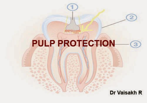 DENTAL MIRACLE .........: Pulp Protection