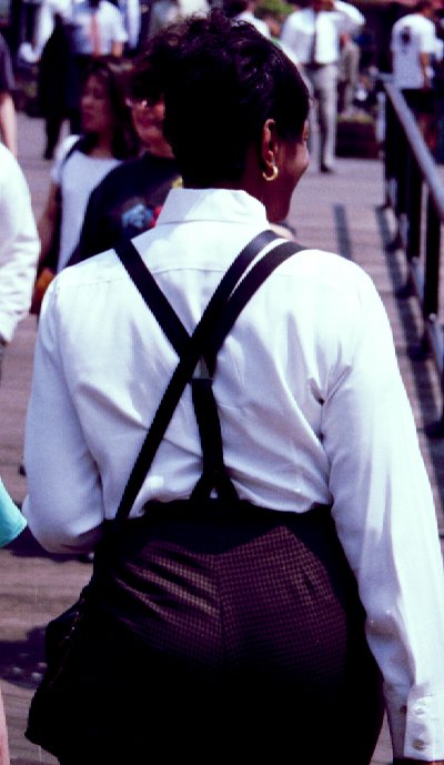 Everything About Braces: Position of Back Junction