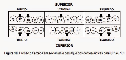 Muito bom esse café !: Índice Periodontal Comunitário (INTPC, CPITN ...