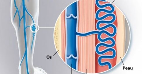 Le traitement naturel le plus efficace contre les varices - Conseils ...