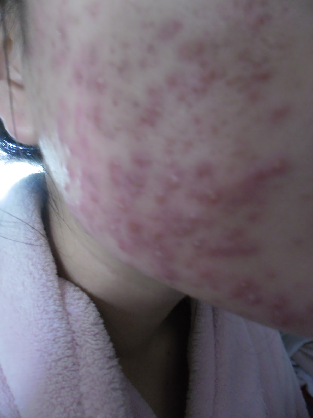 KEEP CALM AND HAVE CLEAR SKIN ♥: June 2012