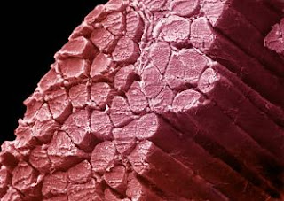 MINHA LUTA CONTRA A BALANÇA: O FUSO MUSCULAR