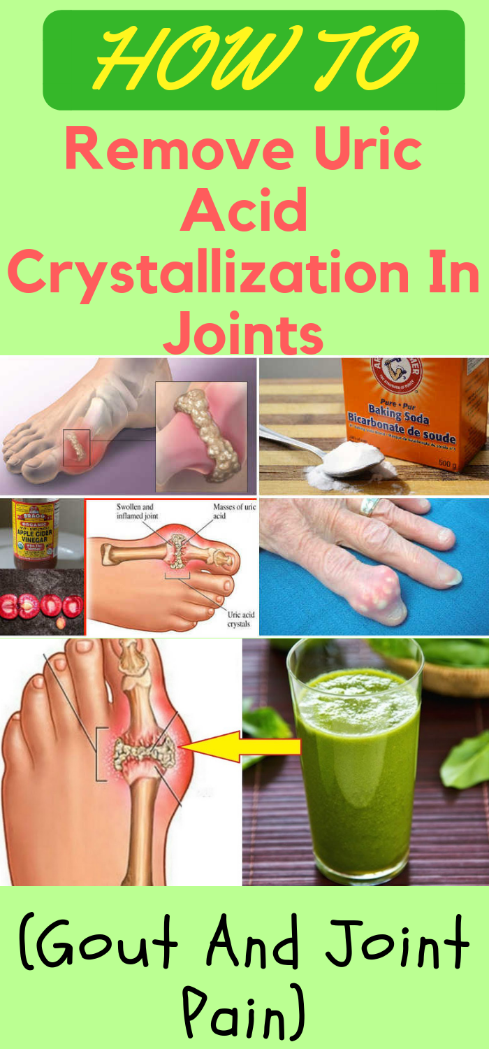 Run Healthy Lifestyle: How to Remove Uric Acid Crystallization In ...