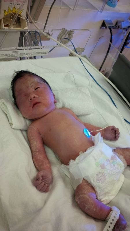 Sticky Bean's Birth Story at 34 weeks - Premature Baby