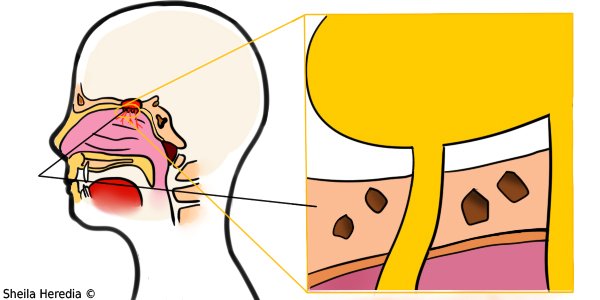 PSICOFISIOLOGIA: Placa cribiforme