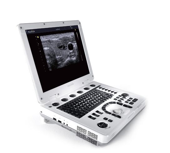 Portable Ultrasound Machine: Portable Ultrasound Samsung MySono U5 Medison
