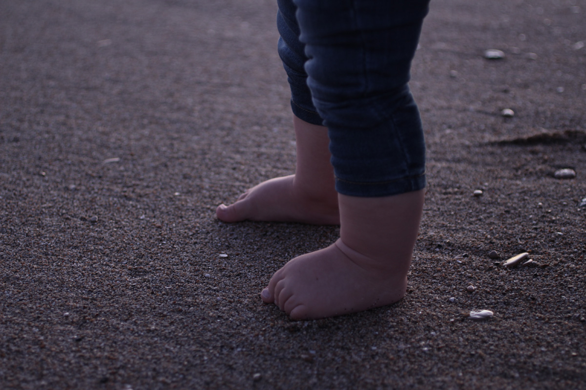 Sinovitis transitoria de cadera en bebés. Nuestra experiencia