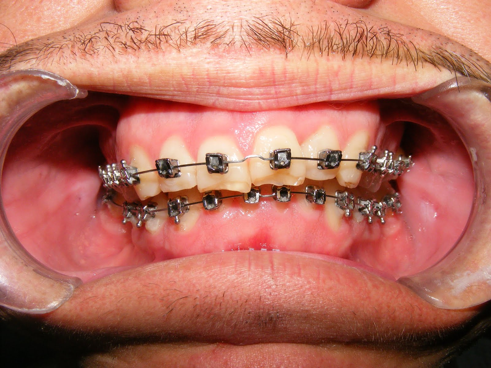 CLinica Dental Siglo XXI