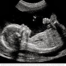 Χριστίνα Π. Βάντζου Μαιευτήρας-Χειρουργός-Γυναικολόγος: Παρενέργειες ...