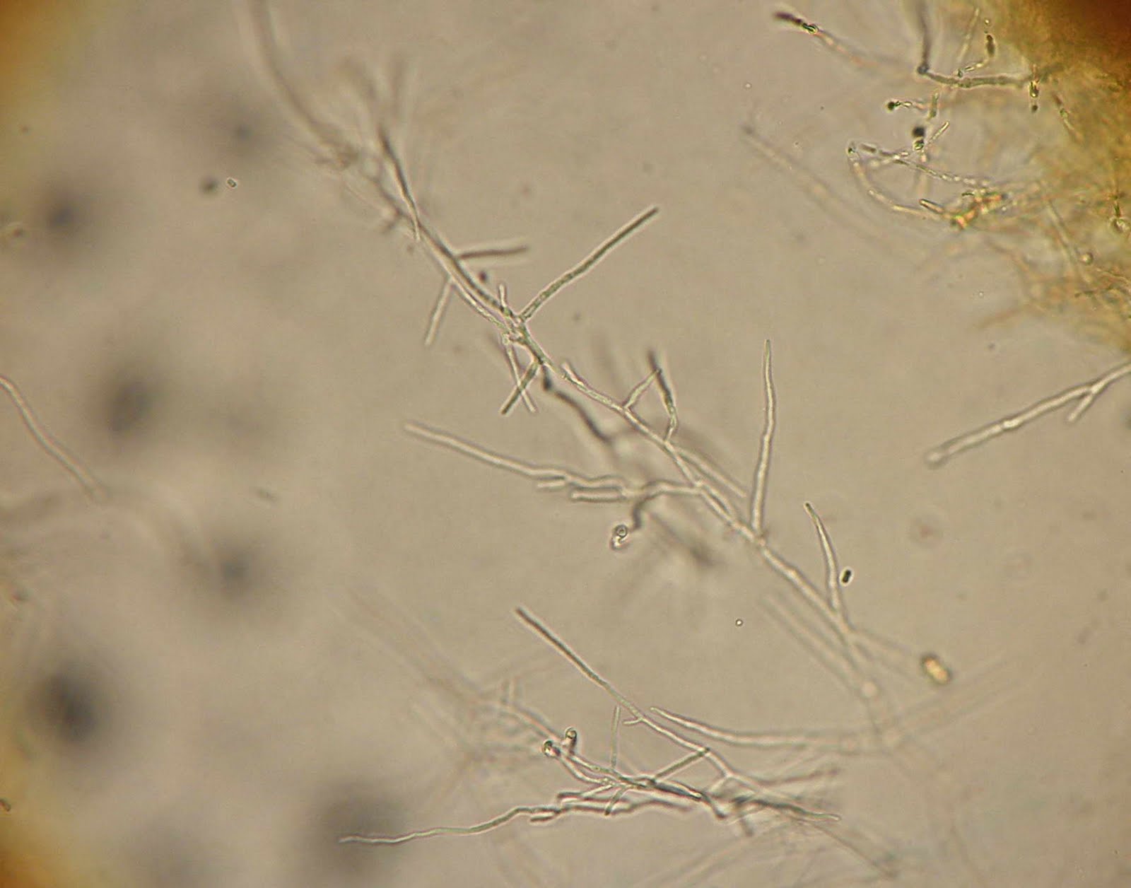 ATLAS MICOLOGIA: TRICHOPHYTON SOUDANENSE