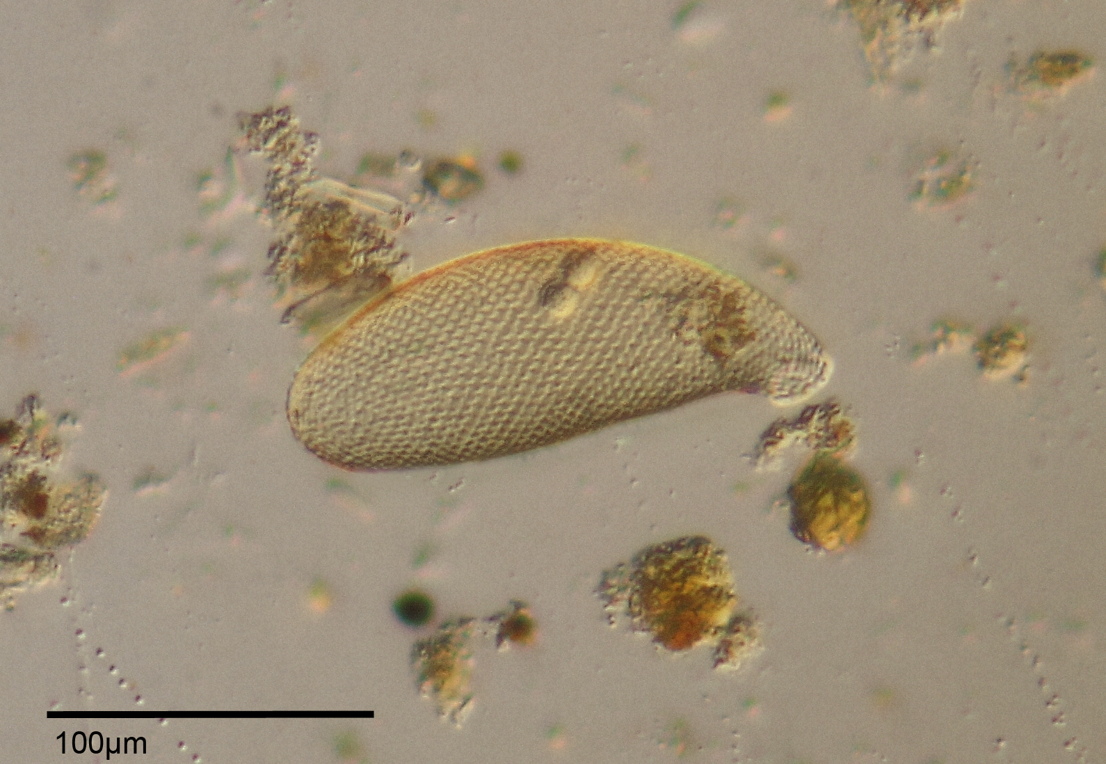 Variety of Life: Euglyphida