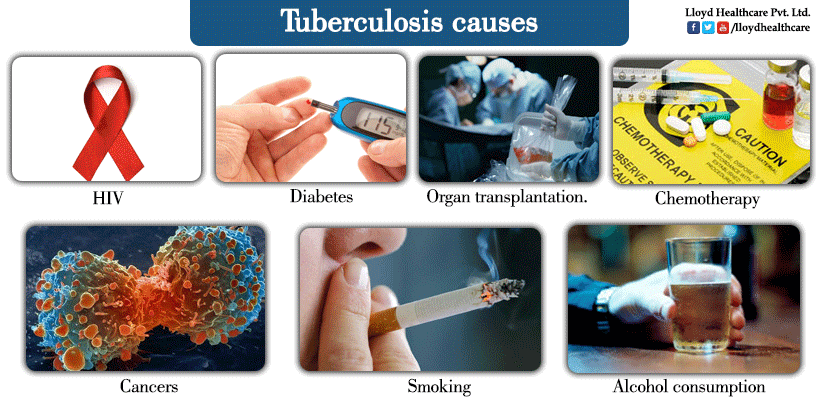 Tuberculosis ( T B ) - Respiratory Diseases
