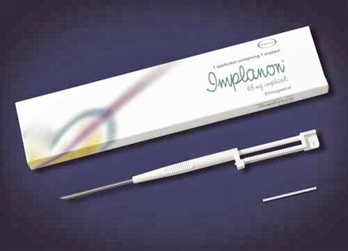 Conversas de Endogirls: O que é Implanon?