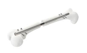 Alargamientos óseos,Medellín-Colombia