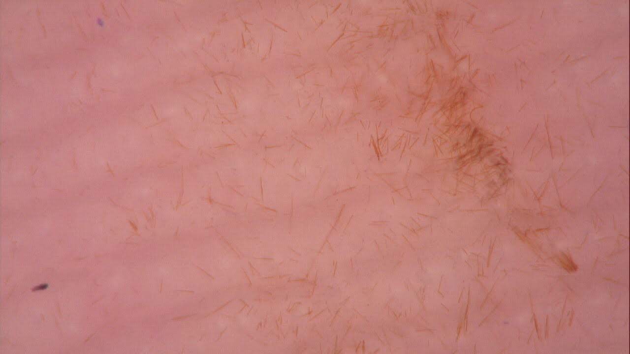 Dermapixel: abril 2019