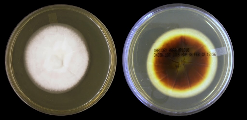 Fun With Microbiology (What's Buggin' You?): Trichophyton rubrum
