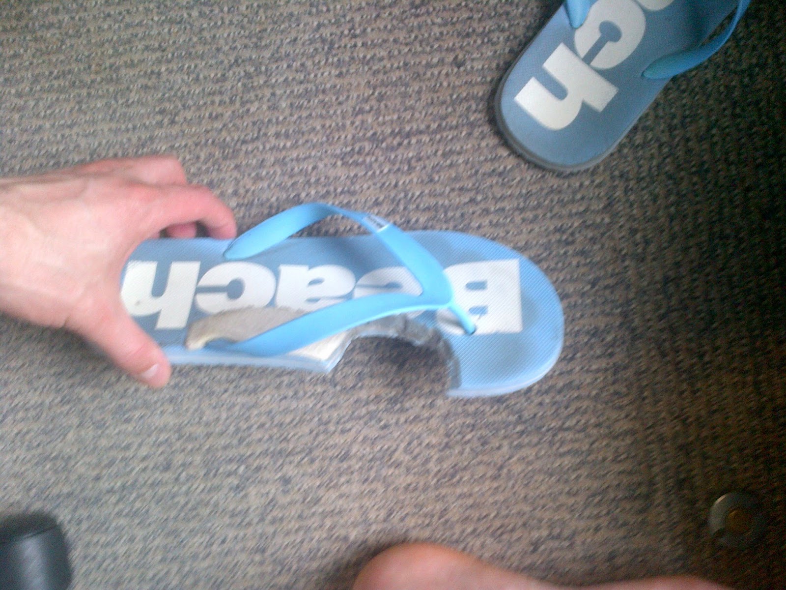 Foot and Ankle Problems By Dr. Richard Blake: Sesamoid Injury: Flip ...