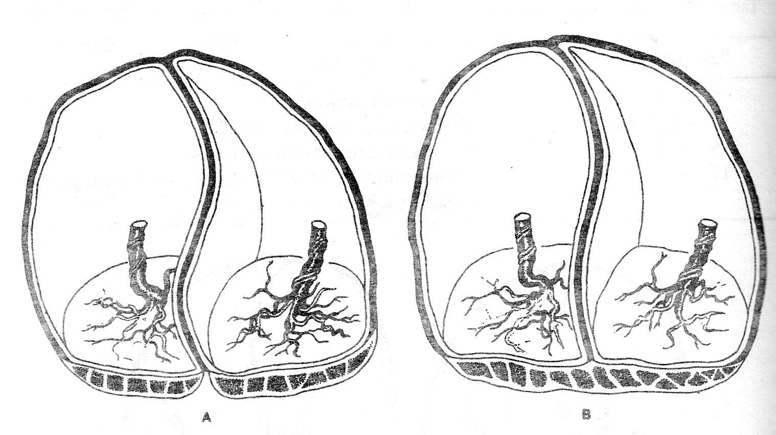 BIDANKU KEREN: KEHAMILAN KEMBAR ( GEMELLI )