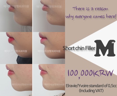 Mademe plastic surgery clinic : The side-effect of Glabella botox ...