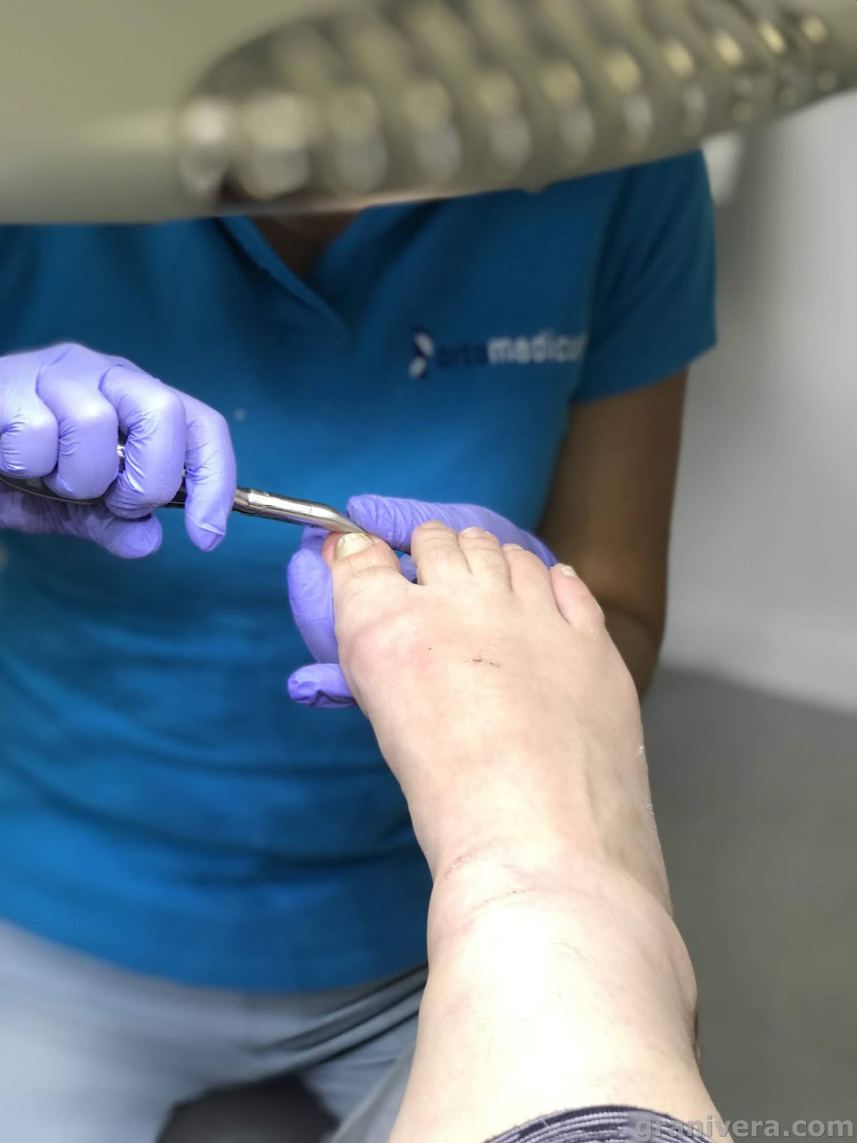 Moja wizyta klinice Ortomedicum w Gliwicach - Pedicure podologiczny dla ...