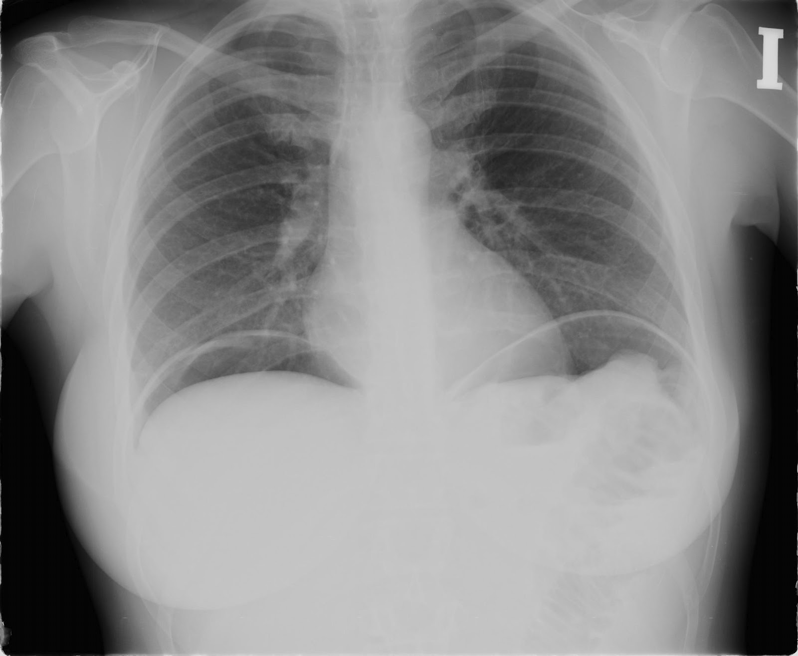 Semiologia Quirurgica: Examen del Tórax y Abdomen