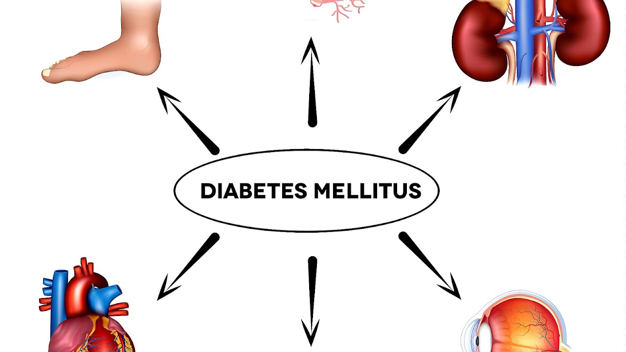 Type 2 Diabetes Side Effects - Effect Choices