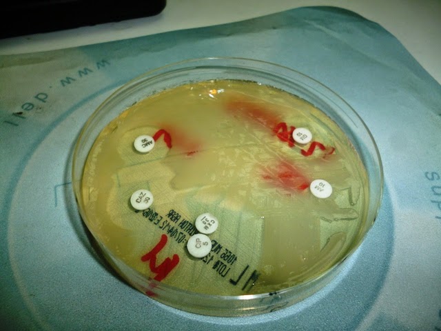 Internal Medicine Pharmacotherapy: Interpreting minimum inhibitory ...