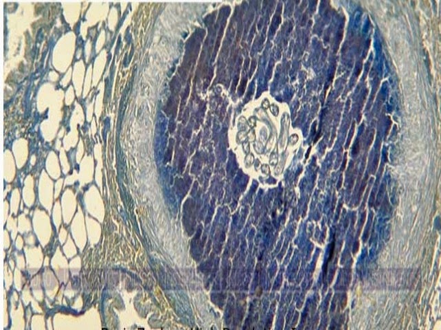 Patologia Veterinária: Pneumonias Parasitárias dos Animais Domésticos