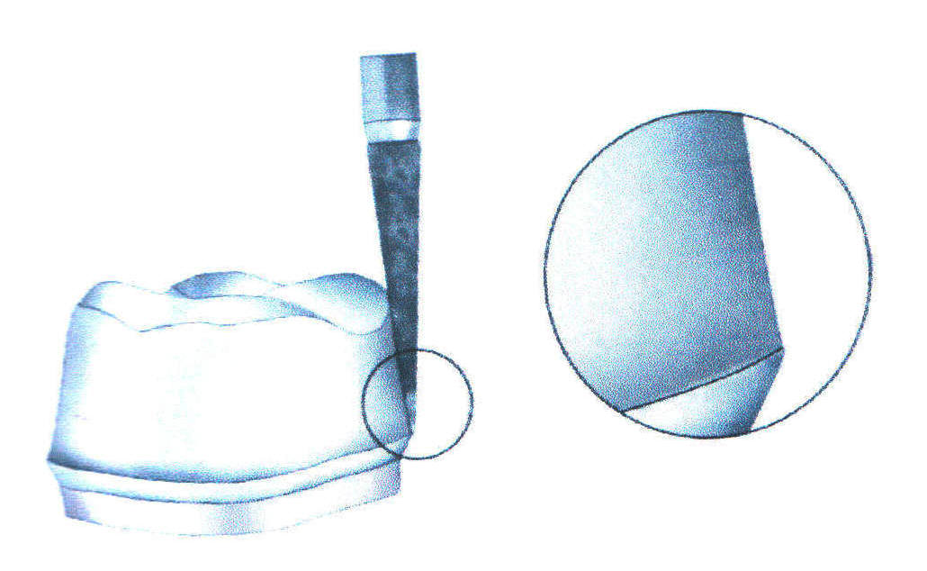 Muito bom esse café !: Linhas de terminações ( Prótese Fixa)