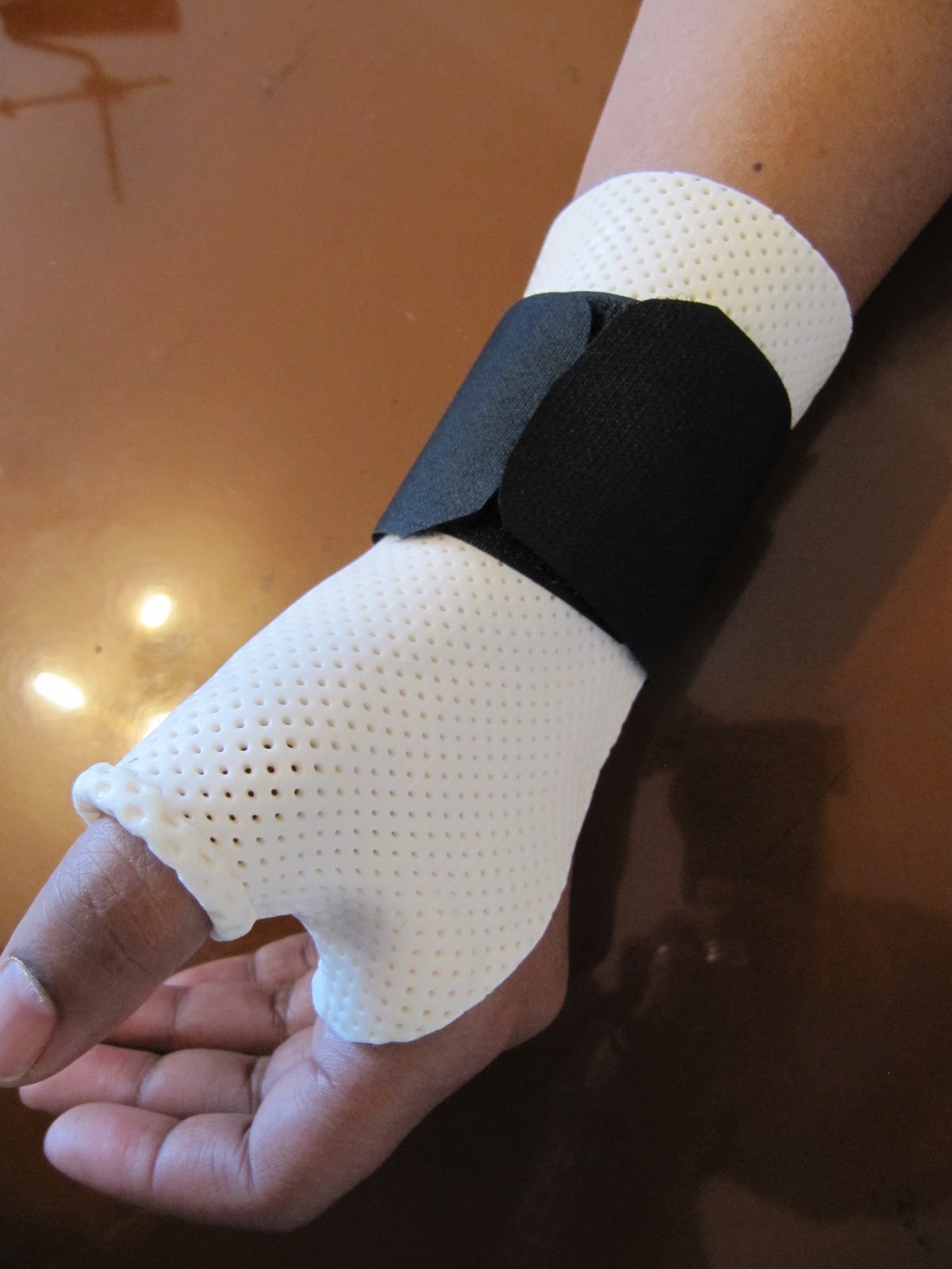 Orthèses Main-Poignet Lyon : rhizarthrose - prévention