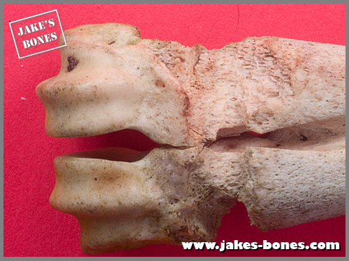 Strange bones #14: Two weird bone pathologies : Jake's Bones