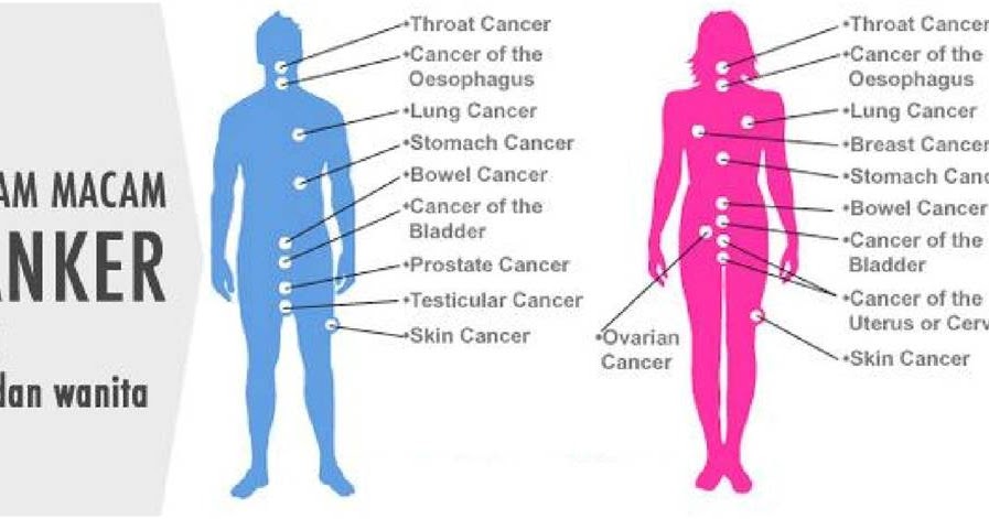Mengenal Beberapa Jenis Kanker yang Mematikan