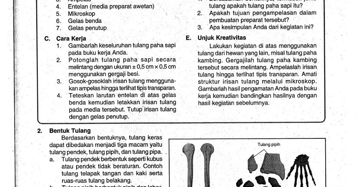 BIOLOGI GONZAGA: SISTEM GERAK SEDERHANA