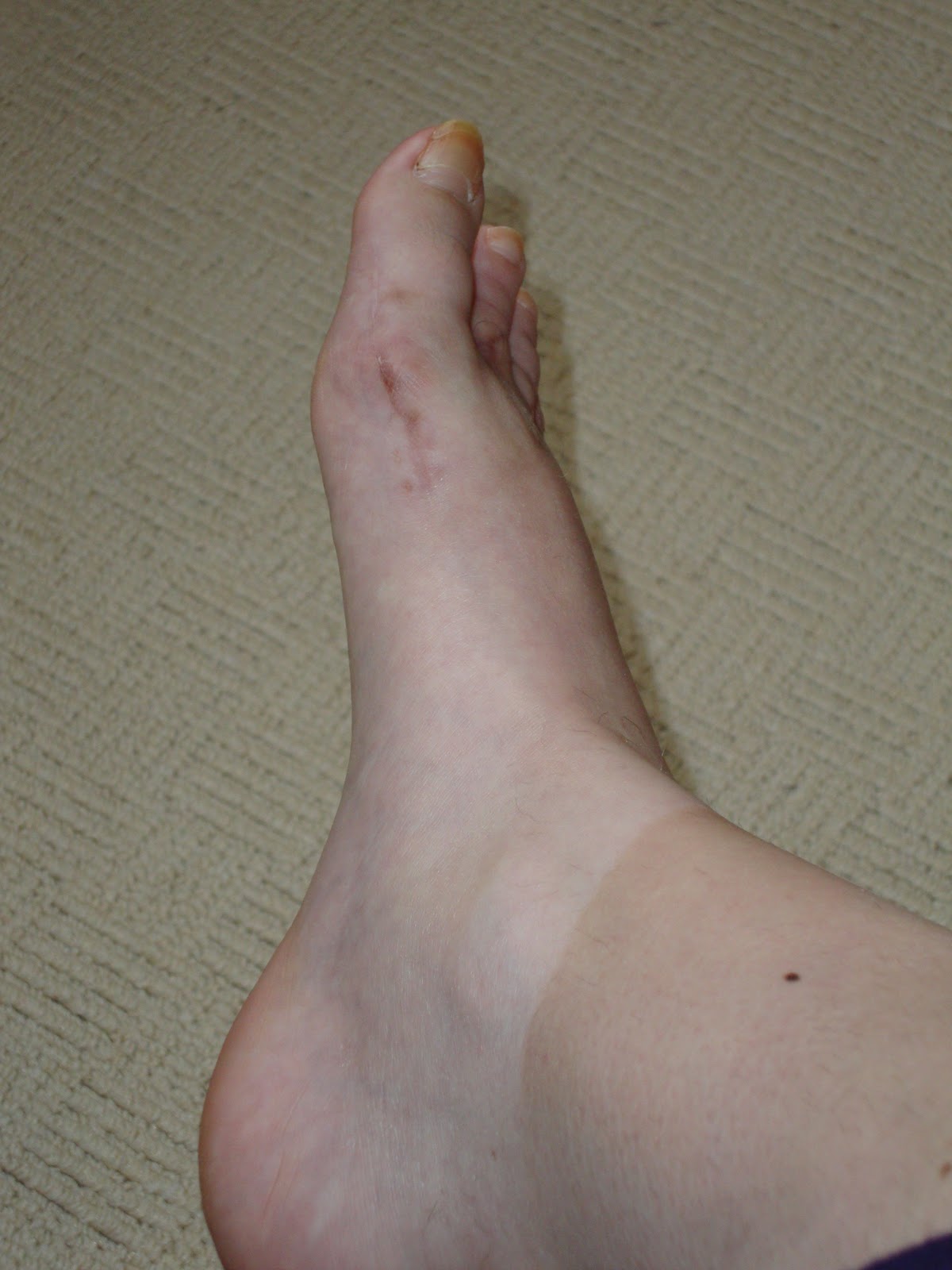 Gwen's Feet (and Hand): October 2011