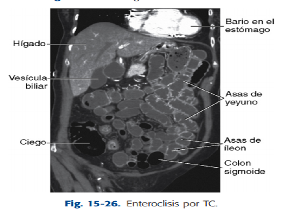 Estudios Contrastados del Sistema Digestivo: Tránsito Del Intestino Delgado