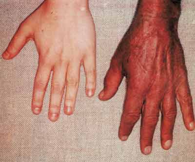 Pathology Cases: Block 2 Case 14 Answers