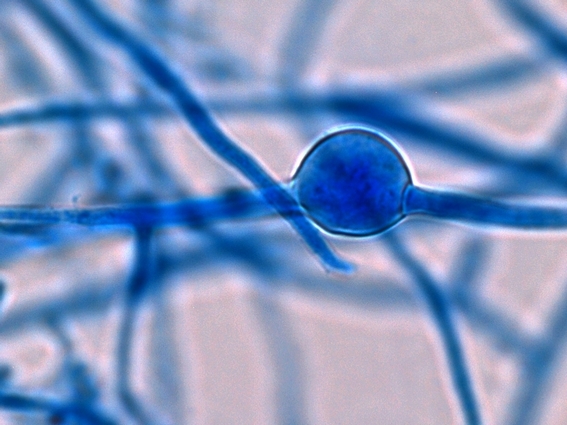 Fun With Microbiology (What's Buggin' You?): Microsporum audouinii