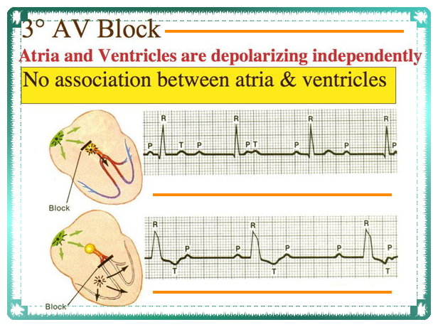 AV block and Its Functionality - Sure Developers Team