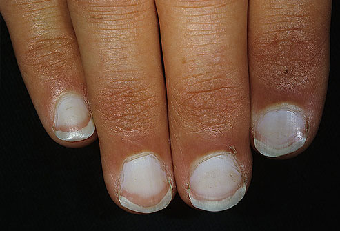 ♥Crisss Unhas♥: O que as unhas dizem sobre sua saúde