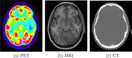 Tecnologia em Radiologia: Diagnóstico por Imagem através da PET/RM