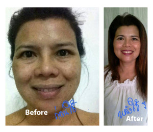 Testimoni Firmax3 Cream - Toko Firmax3 Indonesia