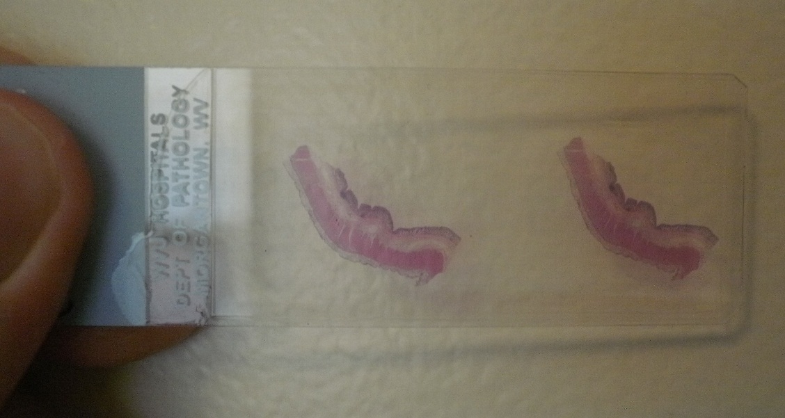 The Making of a Pathologists' Assistant: A Trip to the Histology Laboratory