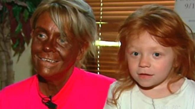 ADICCIONES: TANOREXIA. Cristina Calatayud Sánchez