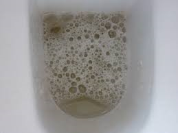 VIVA JOY HEALTH: Watch out FOAMY, BUBBLY urine