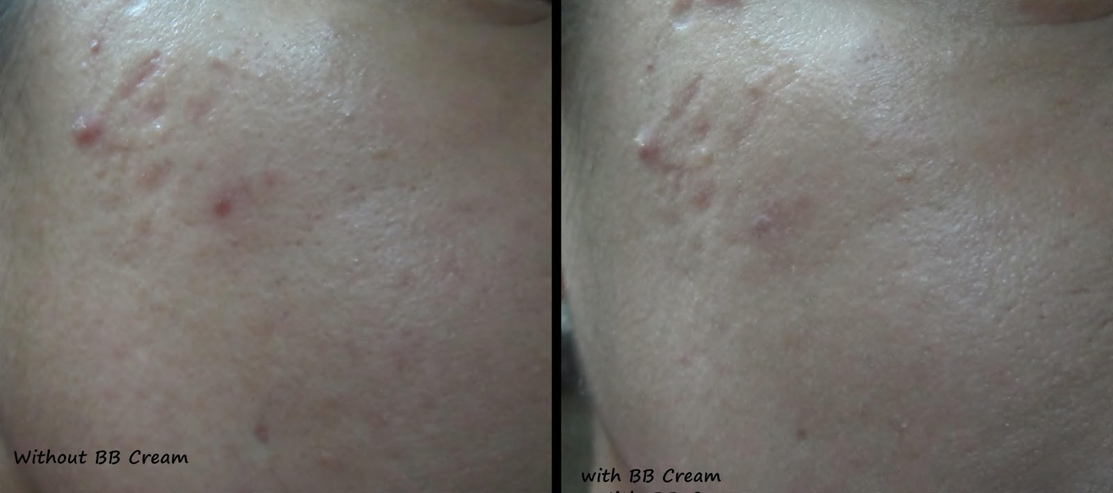 The Unemployed Fish: REVIEW: MIZON Snail Repair Blemish Balm